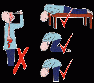 How to use nose drops – Bradford VTS