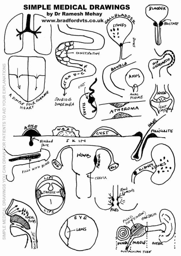 medical explanations – Bradford VTS