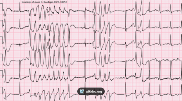 prescribing – Bradford VTS